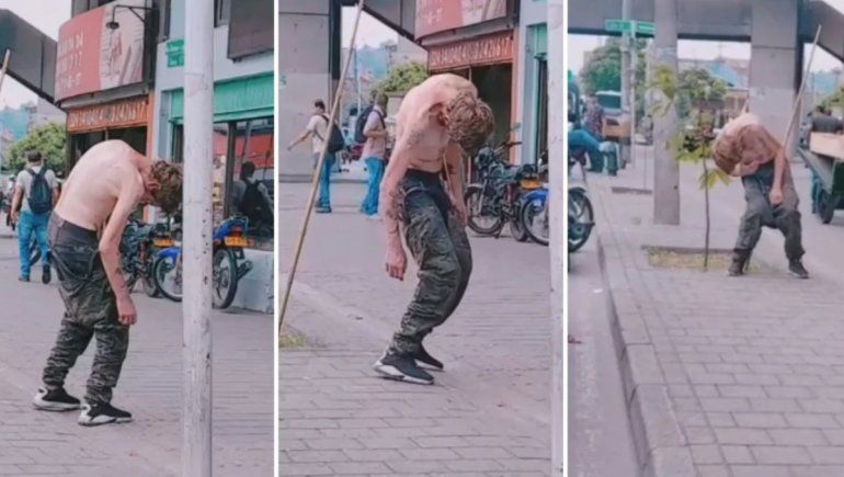 De qué se trata la droga zombie: un analgésico que puede ser letal